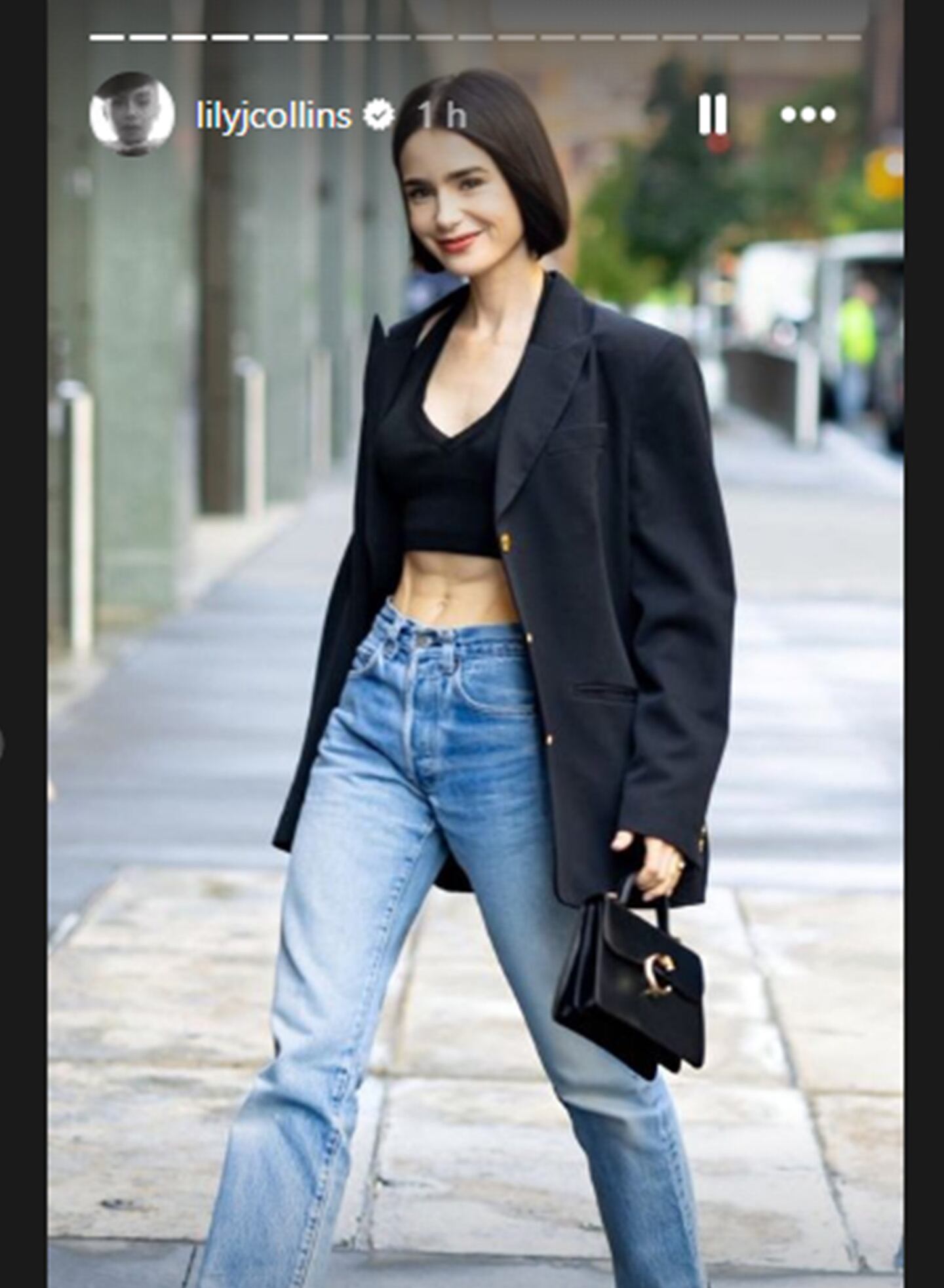 Lily Collins: la foto de su abdomen que sorprendió y generó preocupación en redes – Nueva Mujer