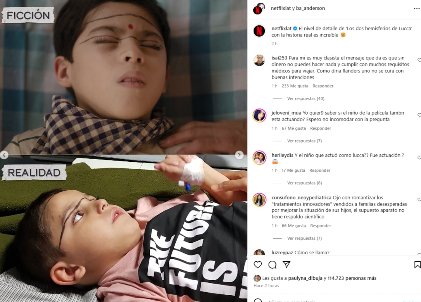 Qué es el Cytotron, el tratamiento para la parálisis cerebral en 'Los ...