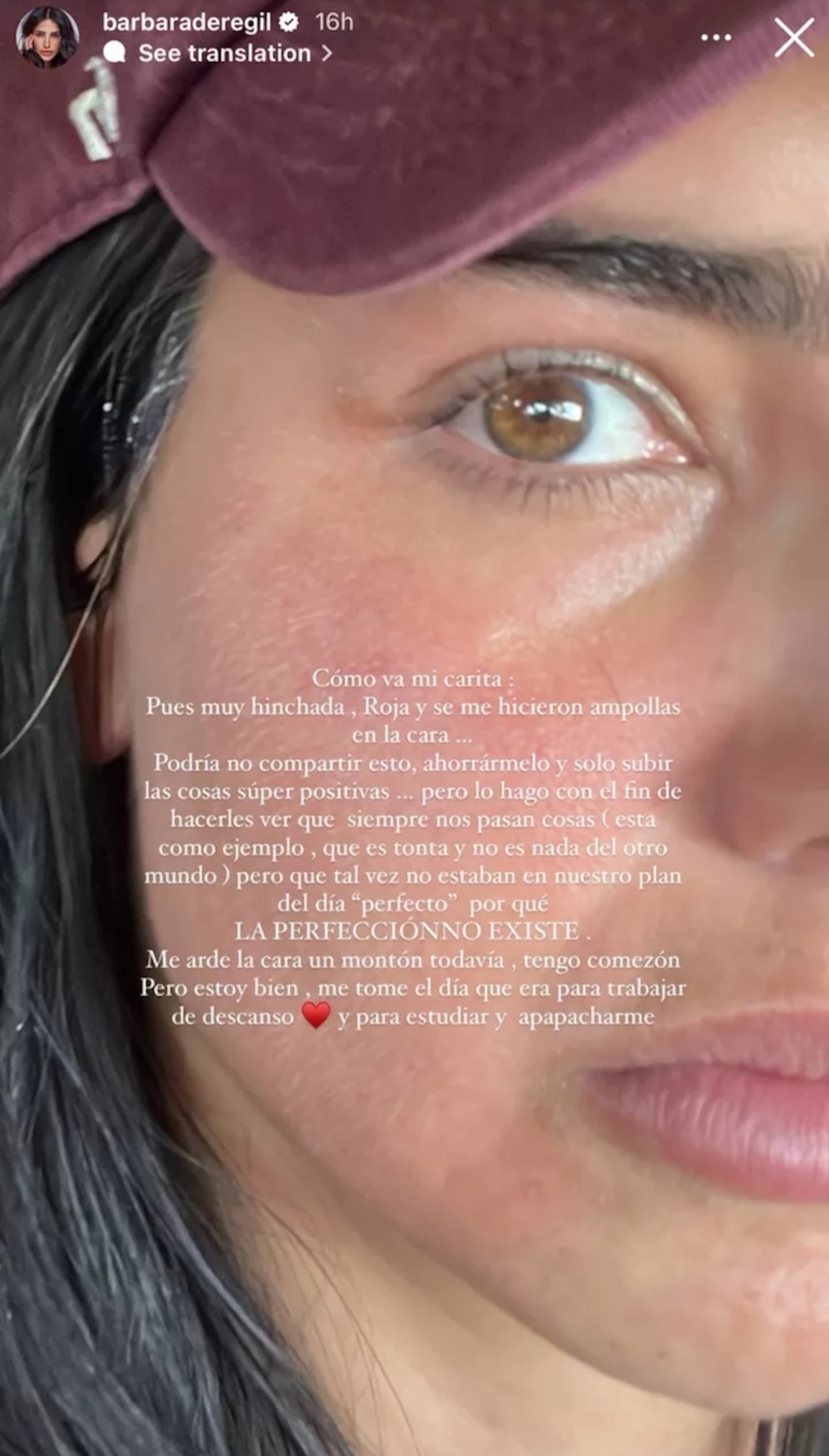 Bárbara de Regil luce rostro ‘deformado’: ¿Qué le pasó? – Nueva Mujer
